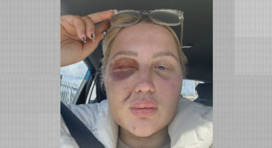 Birkenhead woman calls for overhaul of domestic violence laws after ...