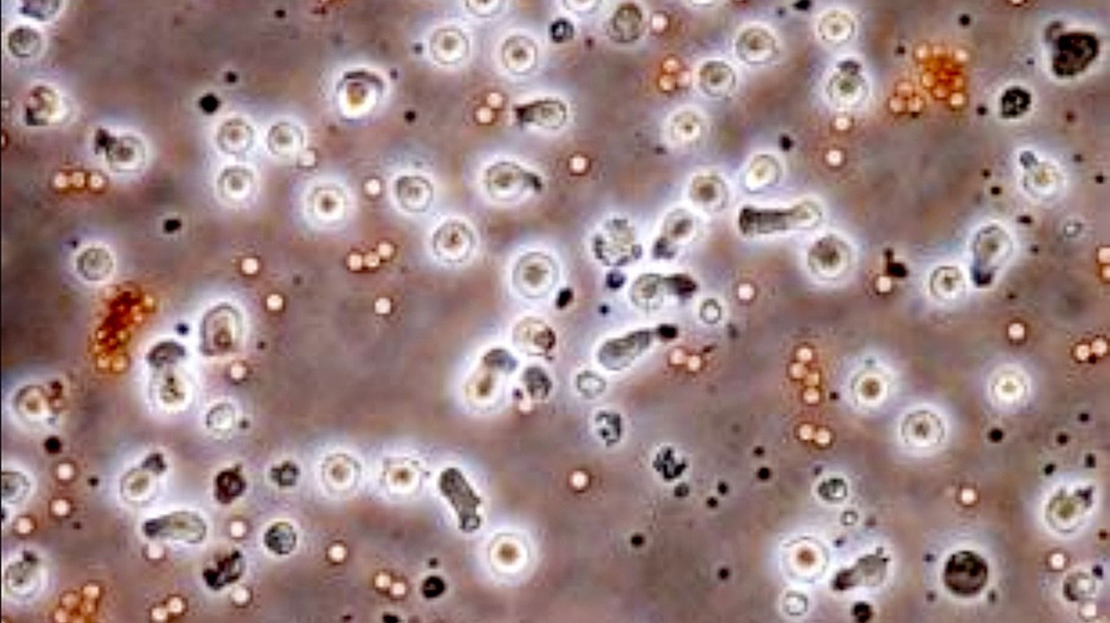 Cardiff scientists suggest the 'prospect of universal cancer therapy ... Cardiff scientists suggest the 'prospect of universal cancer therapy ...