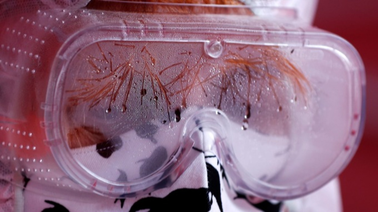 Southend Hospital staff warn of need to cut services due to limited ...