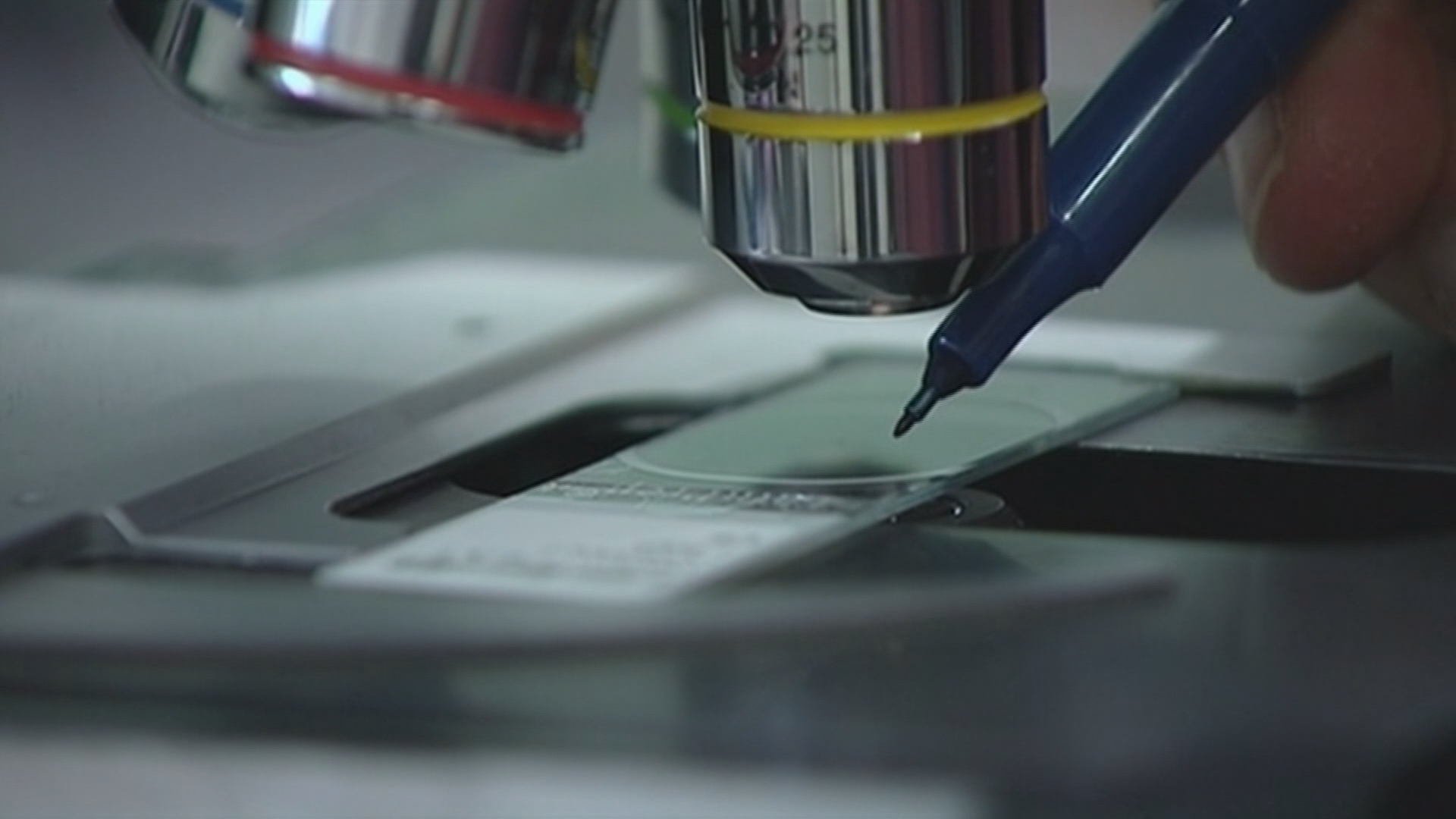 Findings of review into more than 17,000 women's smear tests published ...