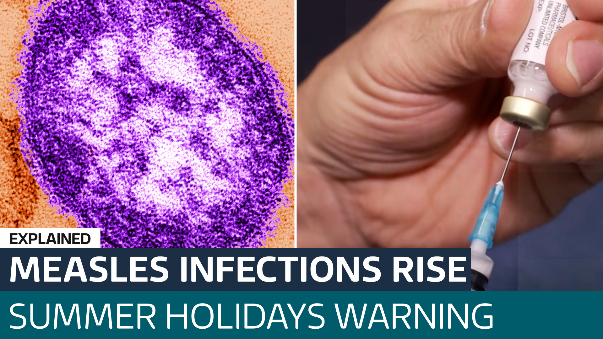 Measles infections on the rise globally with families warned as summer ...