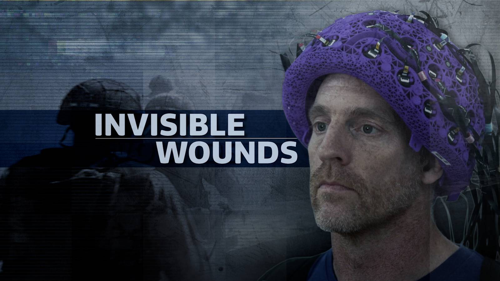 MoD admits British Army weapons systems are causing brain damage in ...