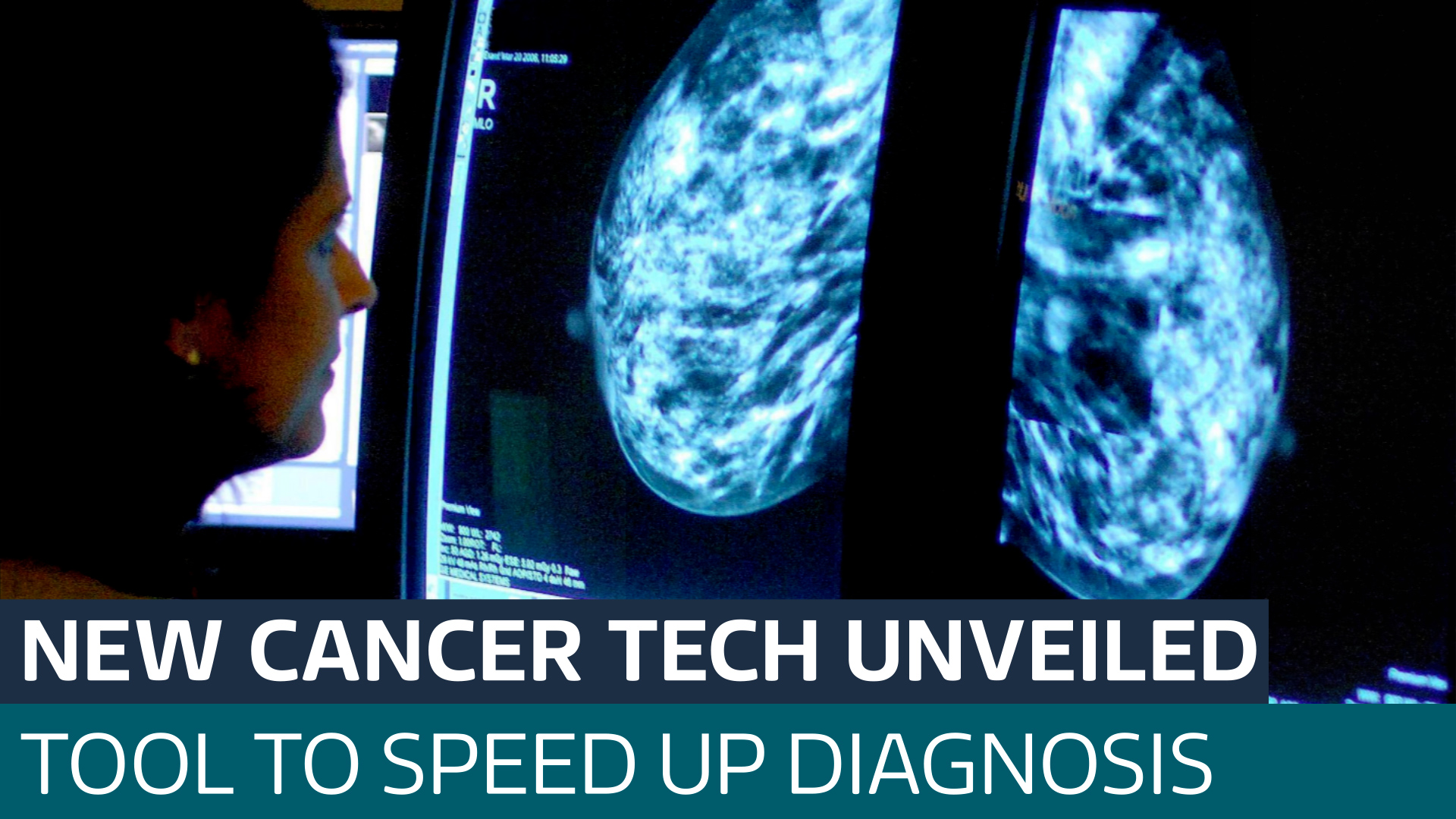 New cancer tech unveiled in effort to 'transform' diagnosis speed ...