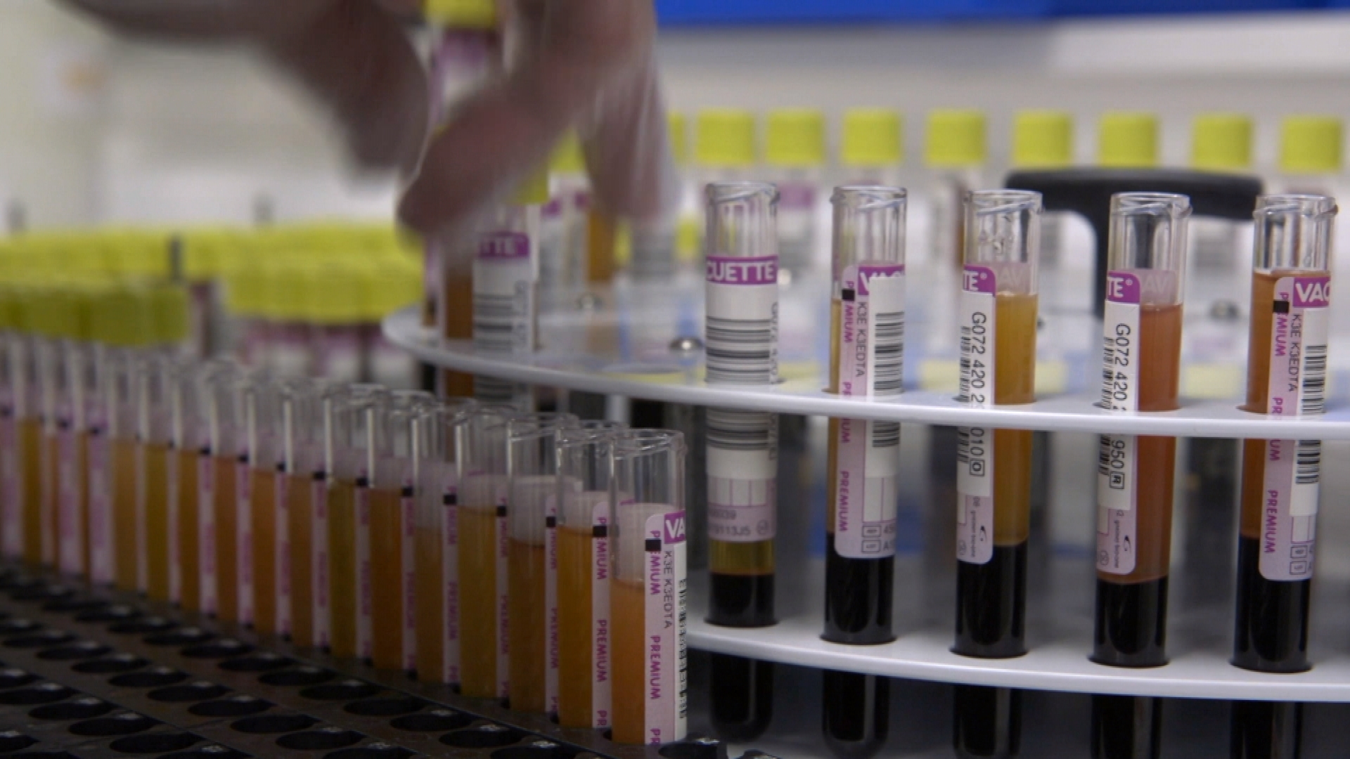 "It is safe and easy, and you could save lives" urgent appeal for blood ...