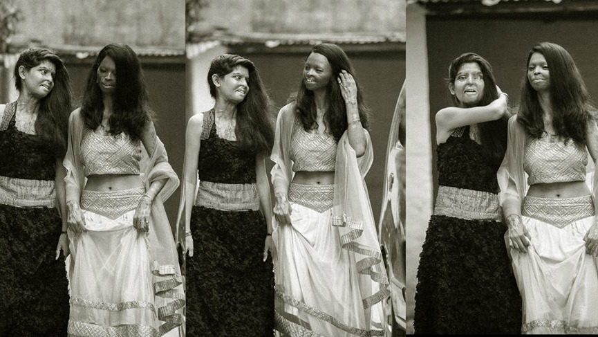 Acid attack victims model for photo shoot in defiance of brutal scars ...