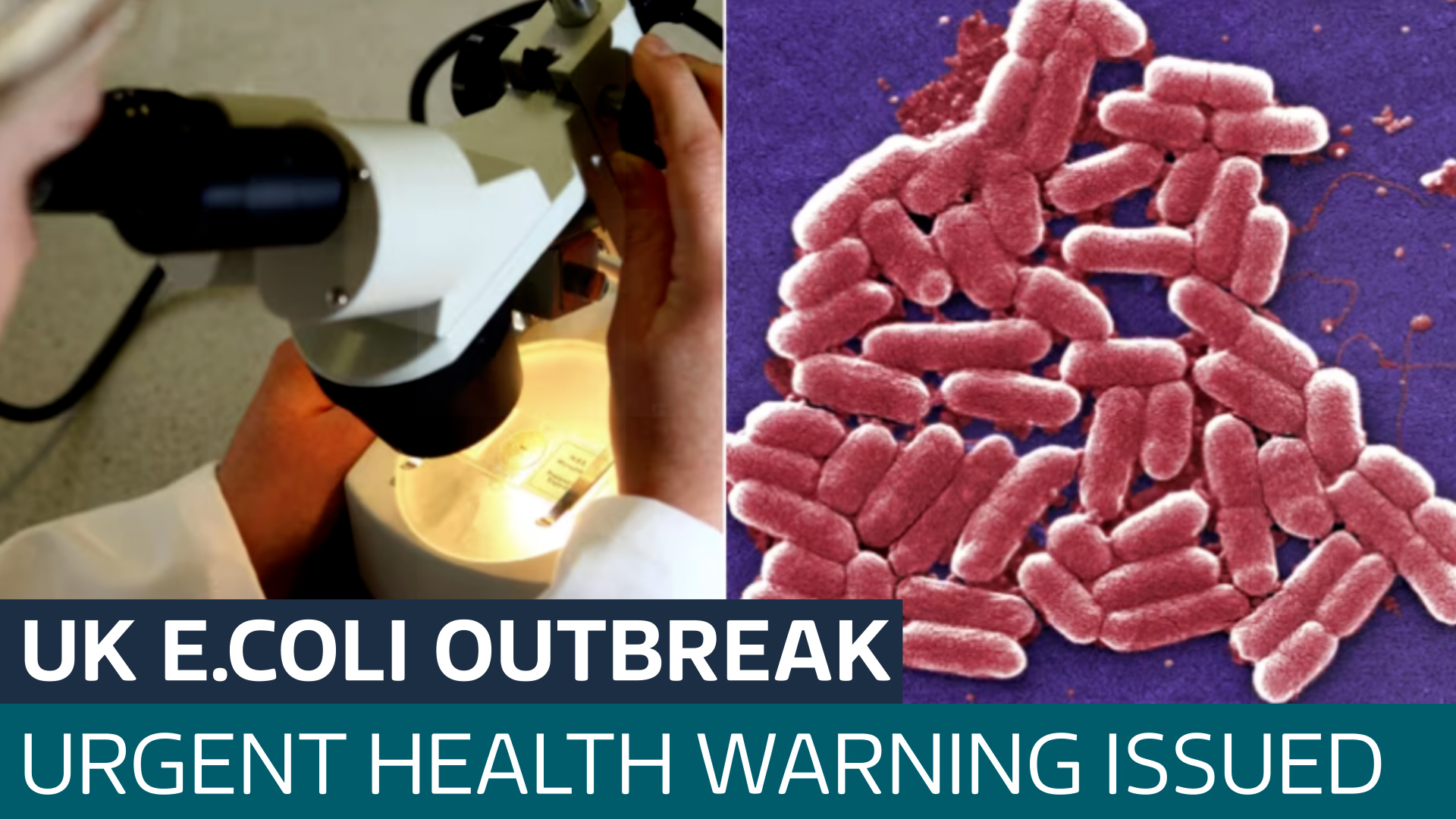 UK E.coli outbreak most likely linked to 'nationally distributed food ...