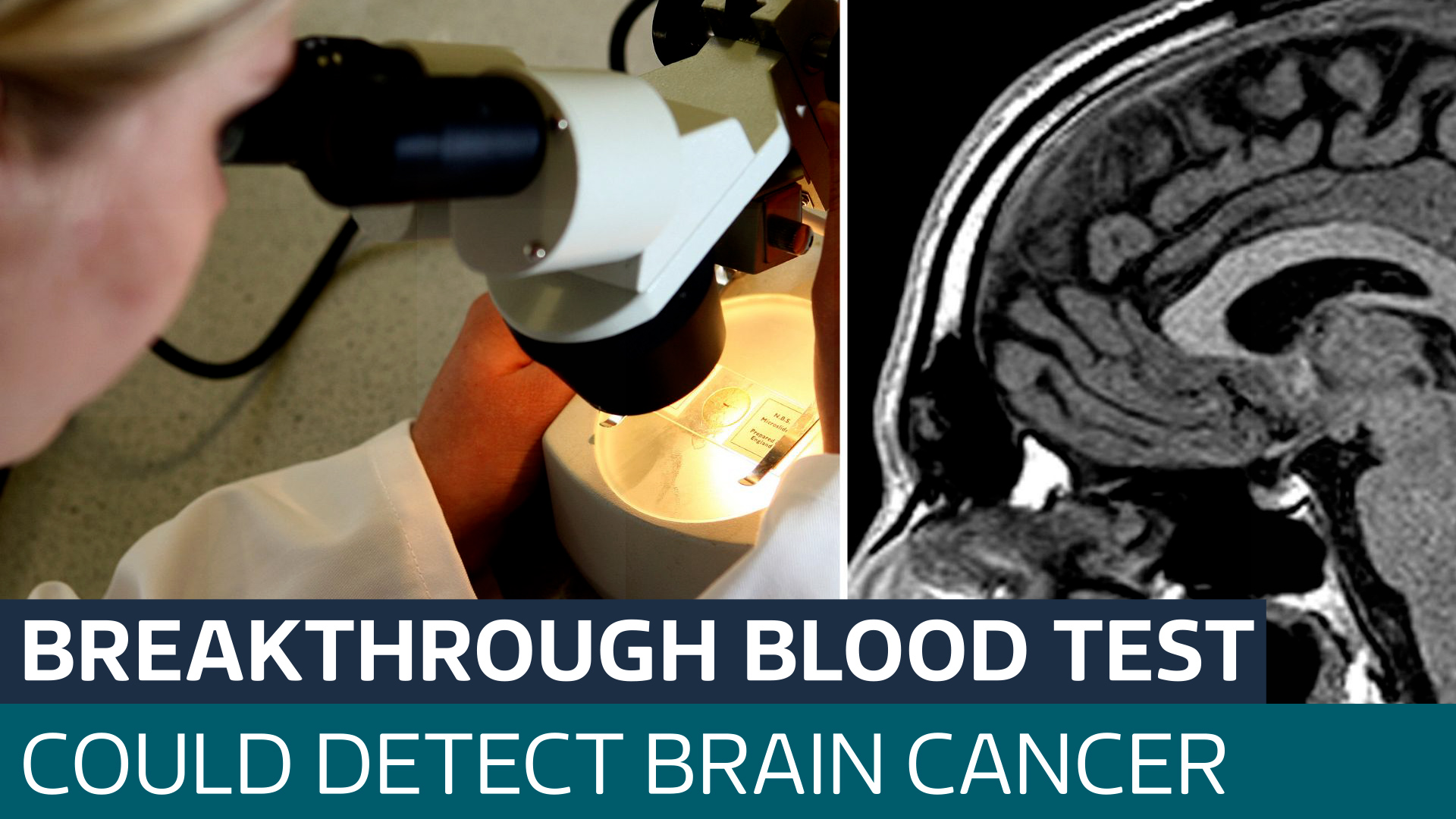 Breakthrough blood test could diagnose deadly brain cancers - Latest ...