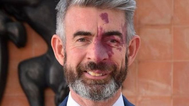 Missing diplomat: Body found in Hampshire forest after four month ...