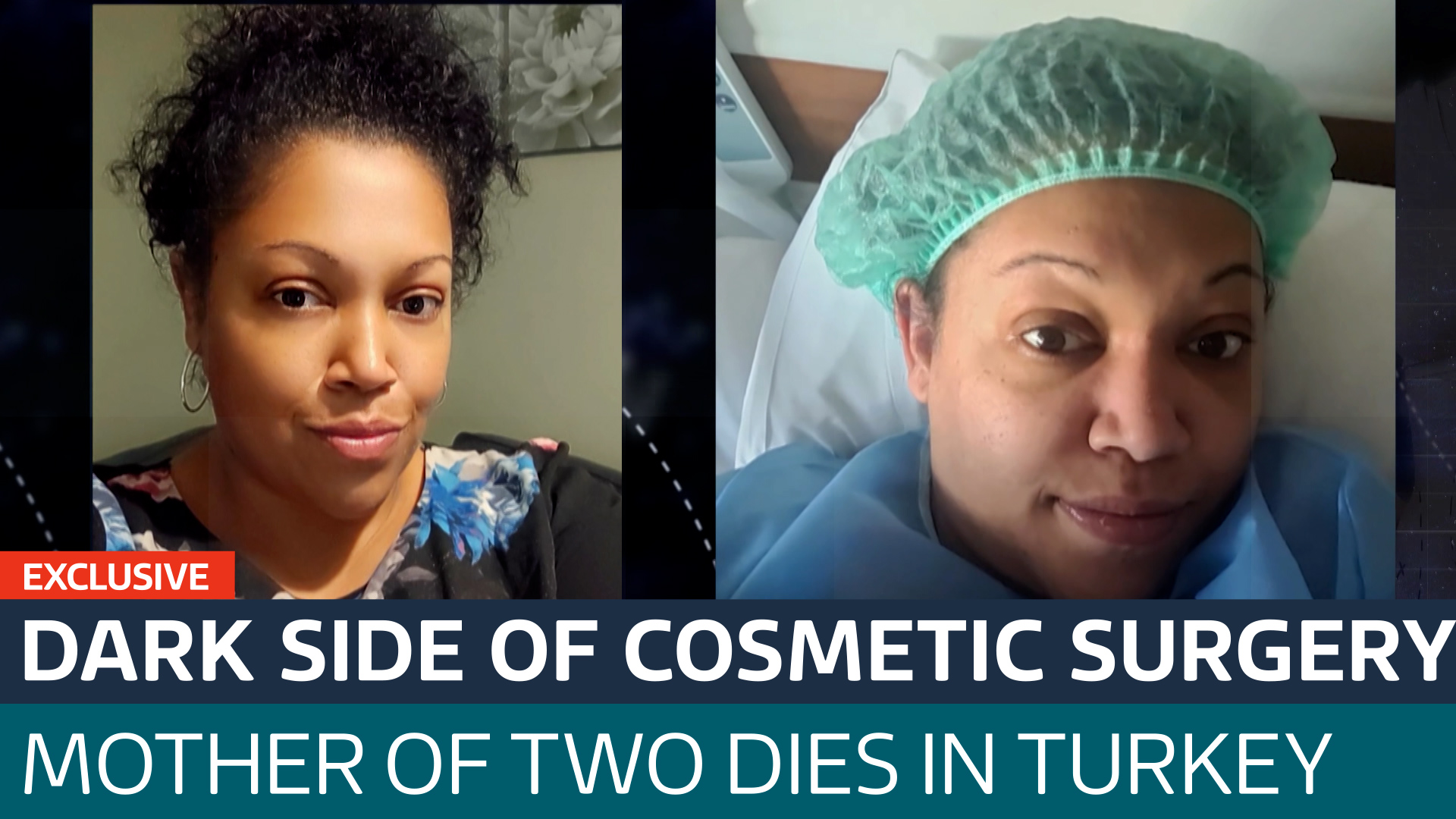 Tragedy in Turkey: British mum dies during ‘Brazilian Butt Lift ...