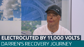 Man's arms 'completely exploded' after touching 11,000 volts of ...