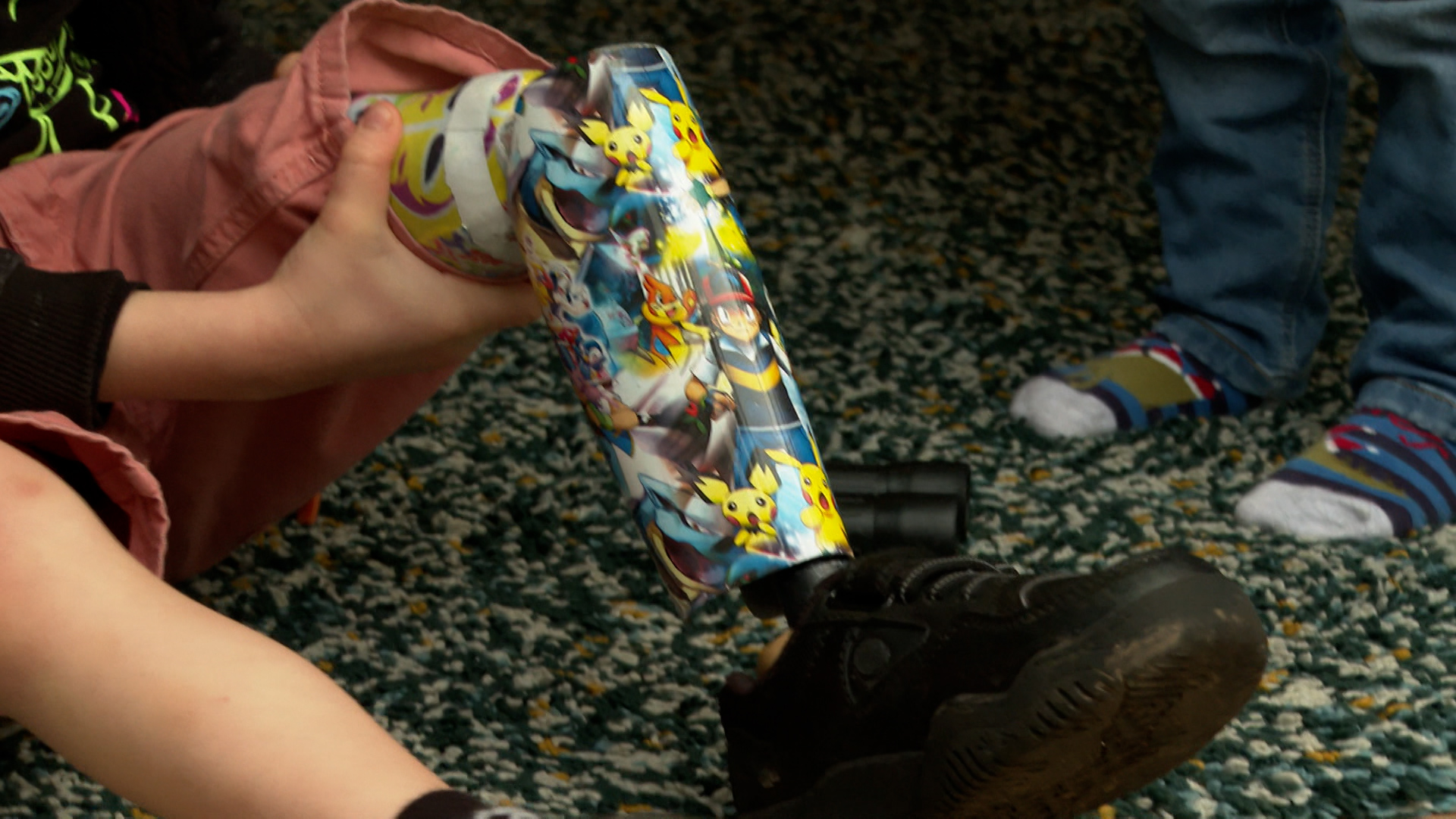 Child amputee from Manchester receives world's first paediatric leg ...