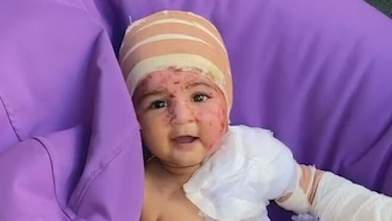 Mum's warning to fellow parents after baby severely scalded by hot ...
