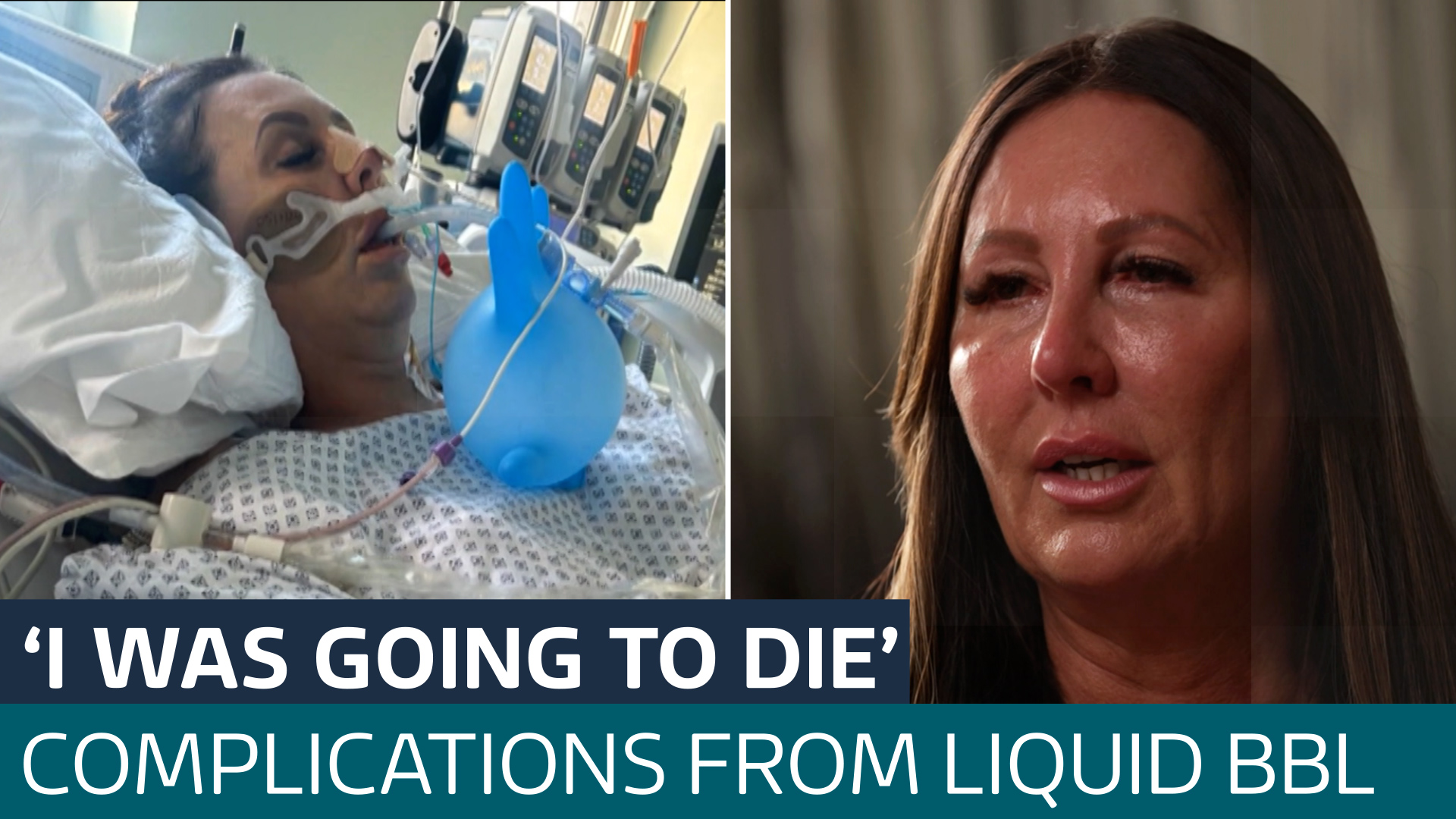 'I was going to die': Mum in coma after botched liquid BBL led to organ ...