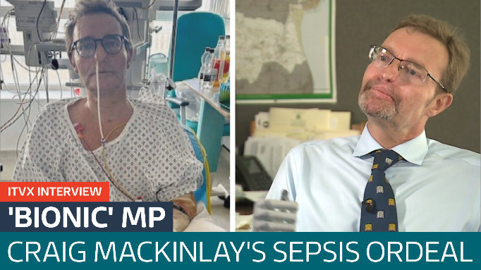 'Bionic' MP Craig Mackinlay was two hours away from death in sepsis ...