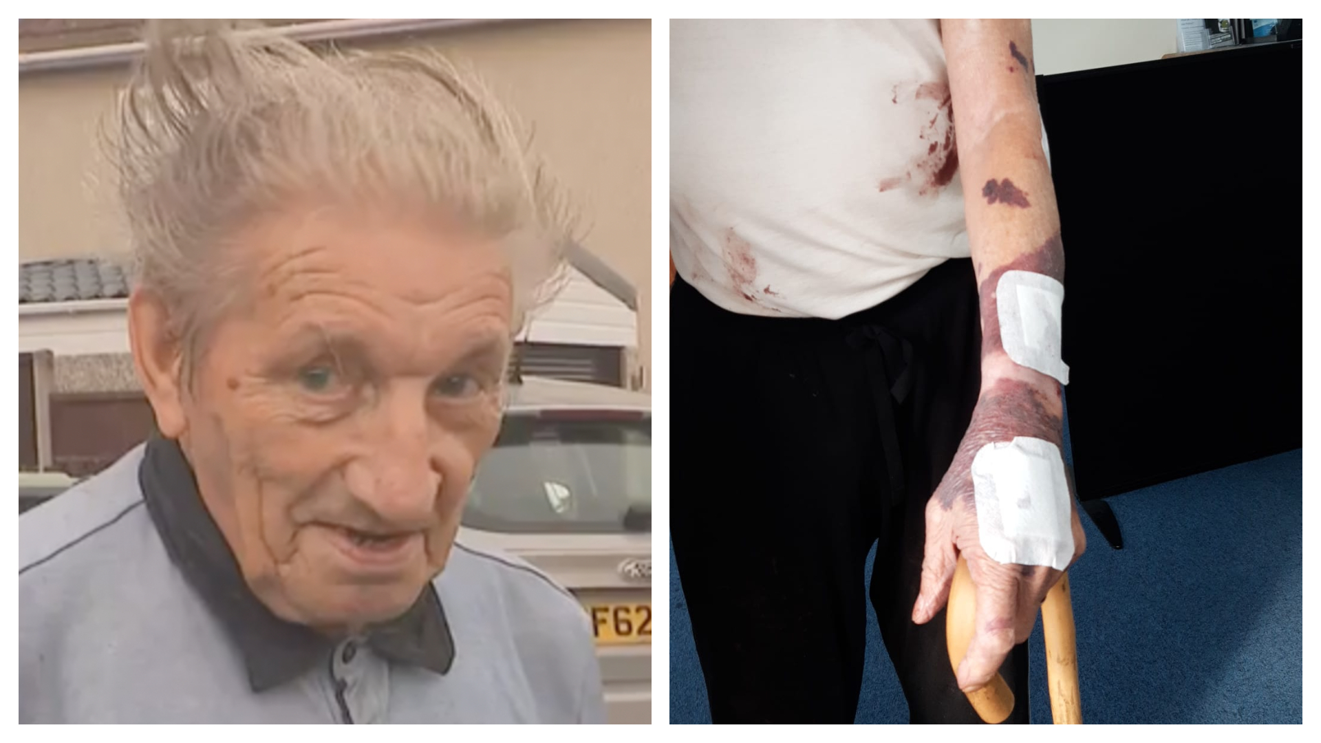 Bedfordshire Police apologise to grandfather, 81, left with bloody ...