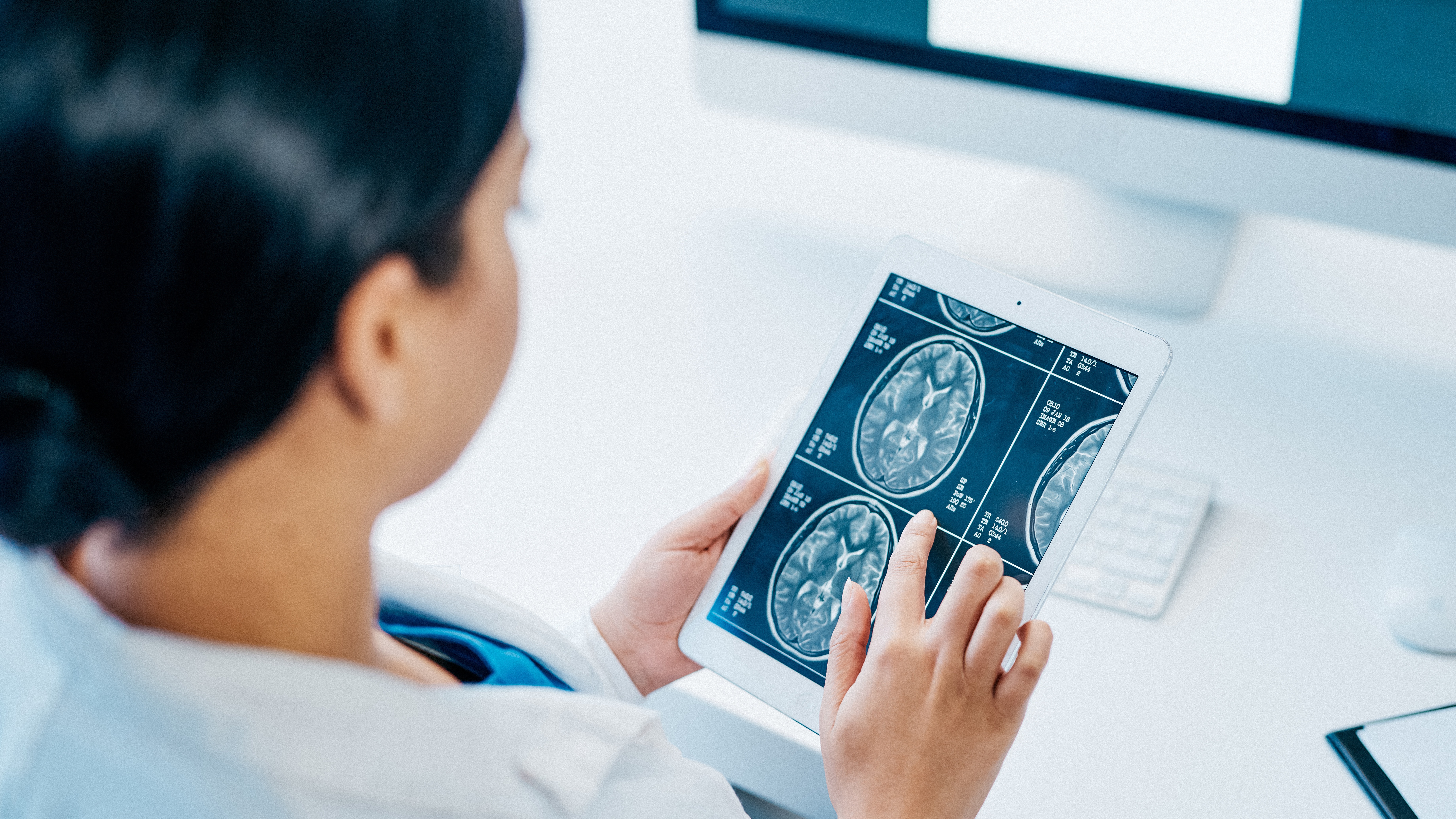 Menopause causes loss of brain matter which could explain women's ...