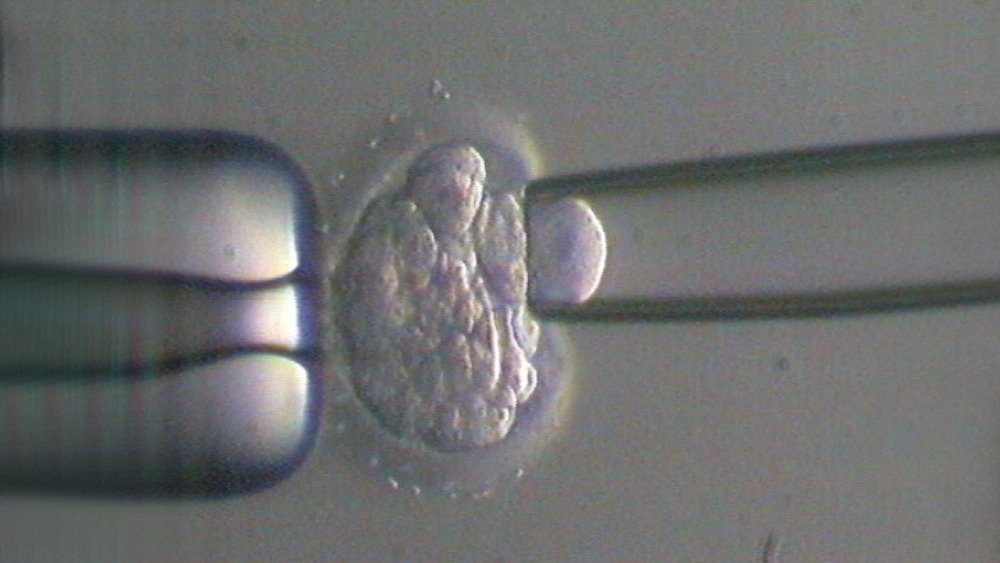 NICE recommends IVF for older women | ITV News