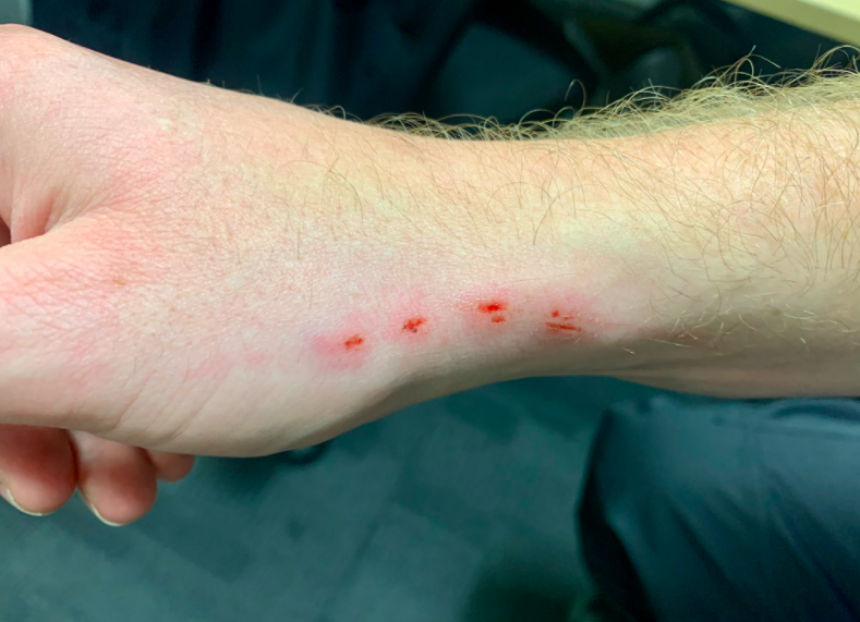 Bradford man arrested after allegedly claiming to have coronavirus ...