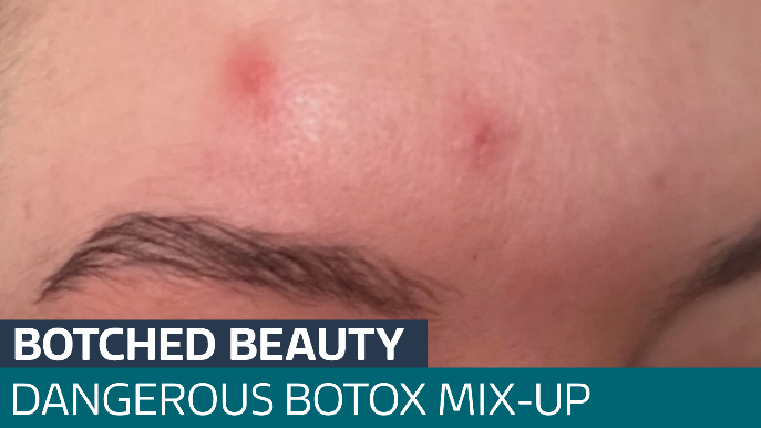 Woman claims botox mix-up could have left her blind - Latest From ITV News