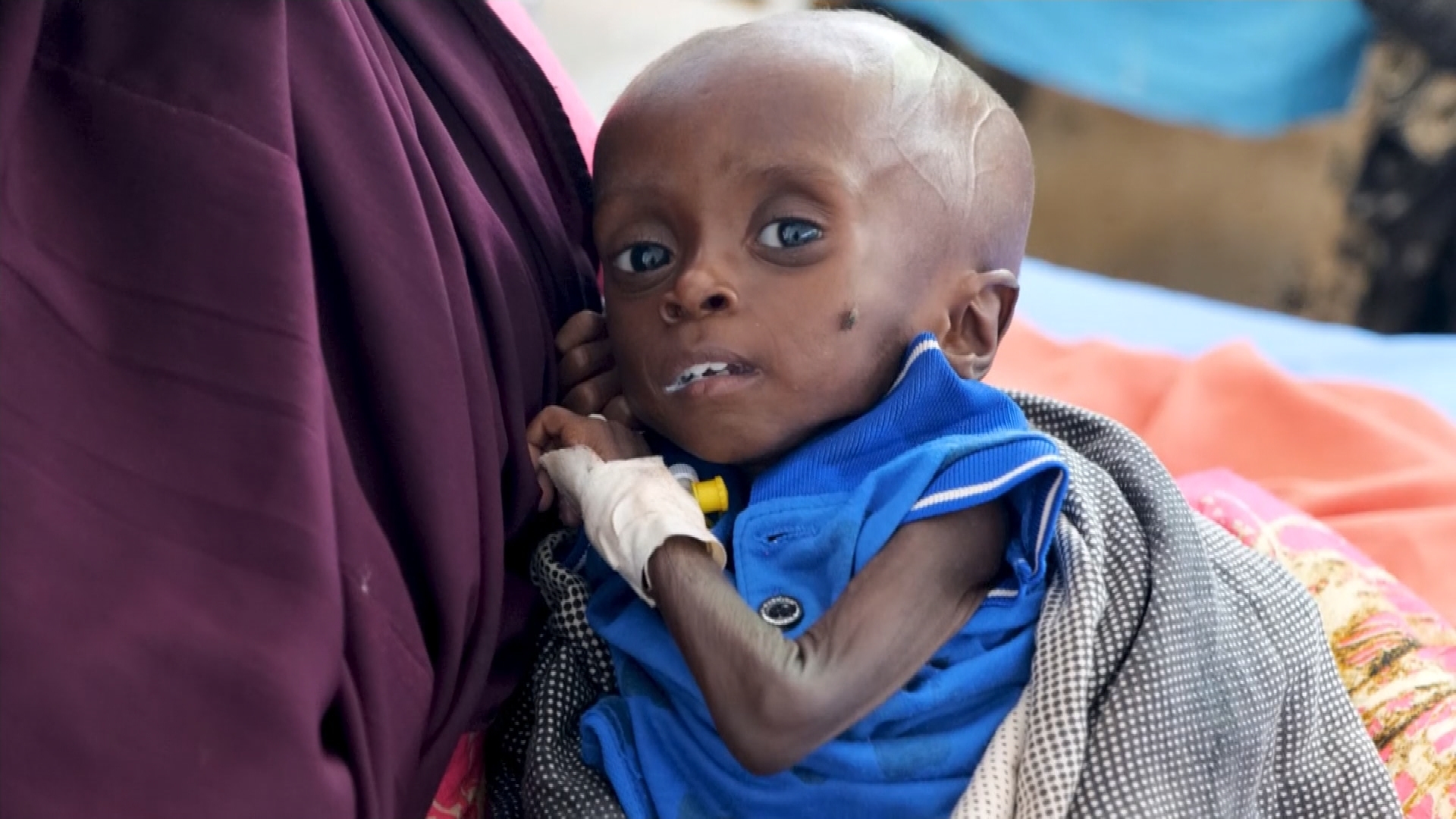 What are the solutions to East Africa's hunger crisis and how can you ...