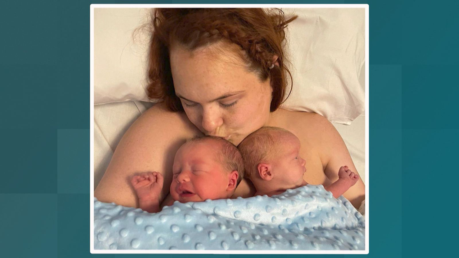 Number of mums seeking post natal mental health support at Southern ... Number of mums seeking post natal mental health support at Southern ...