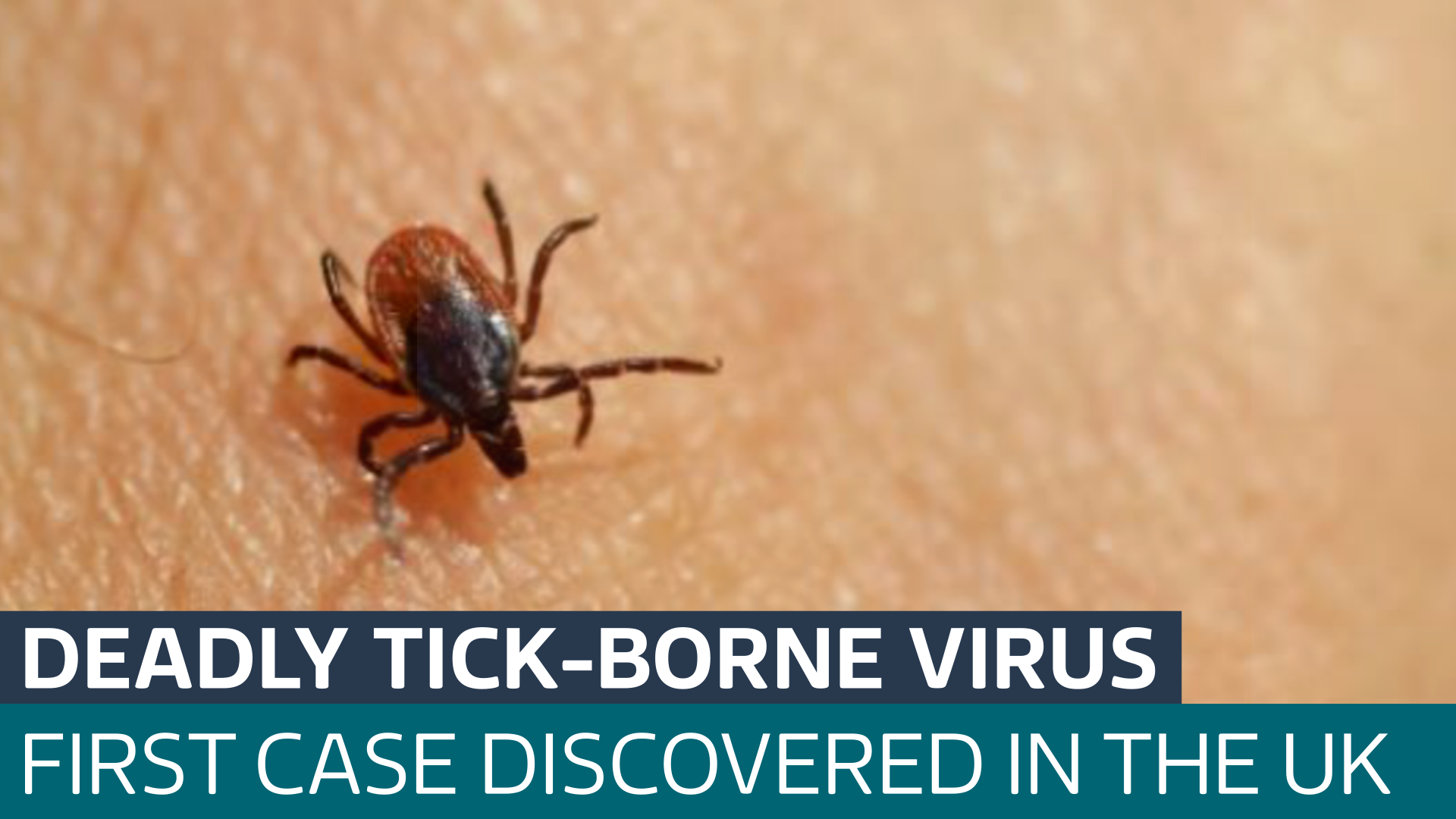 Deadly tick-borne virus 'likely' to be in the UK after first case ...