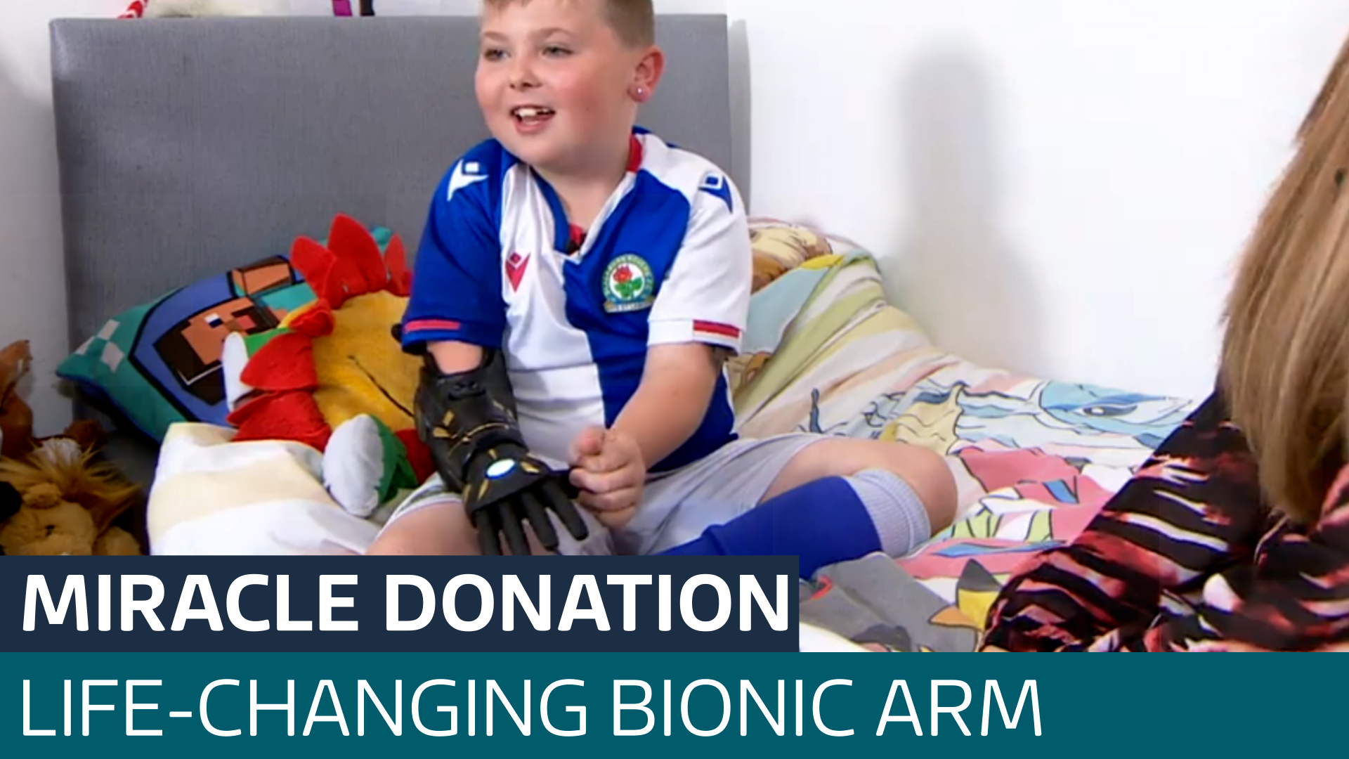 How a stranger paid for a seven-year-old's life-changing bionic arm ...