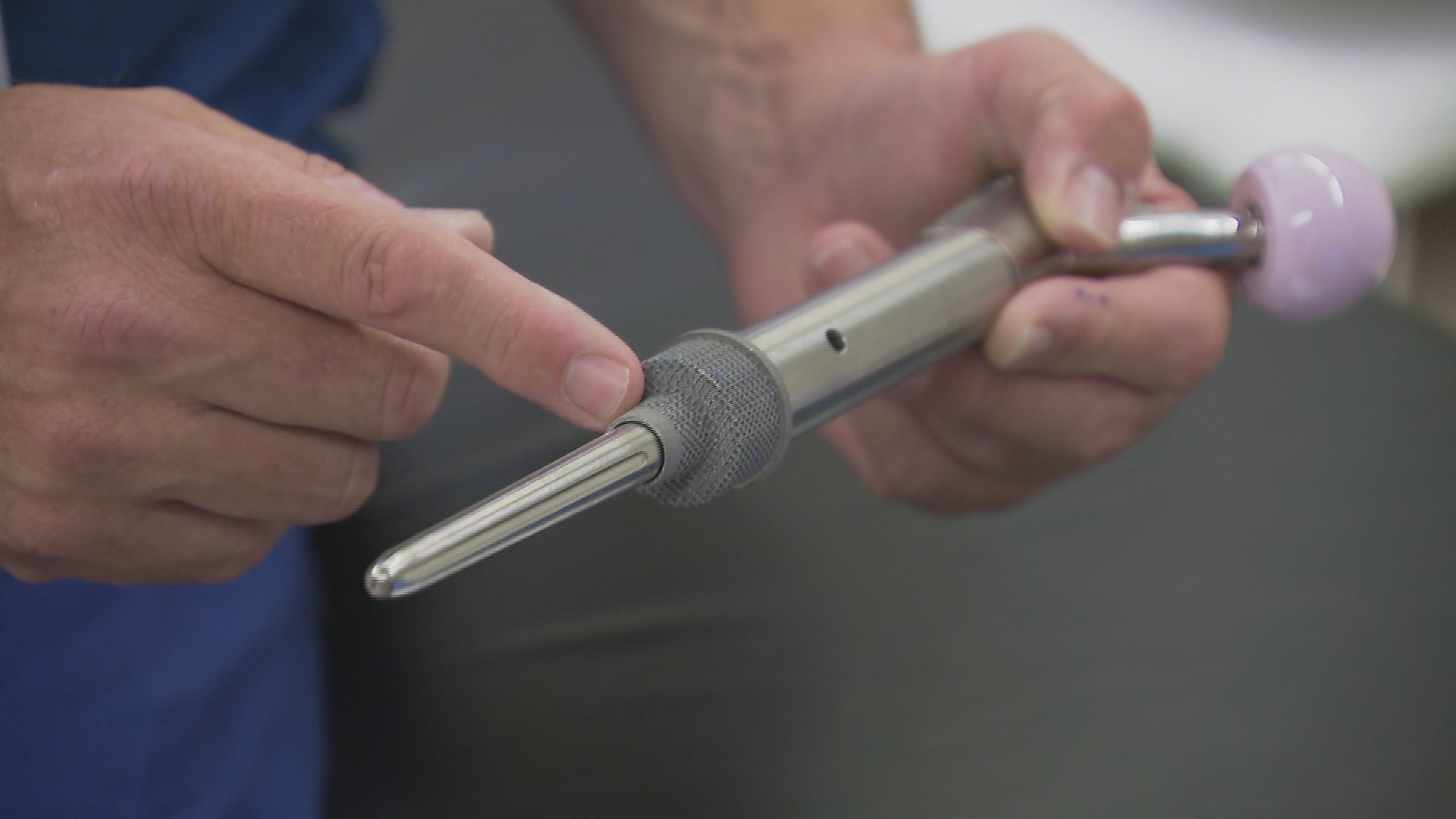 NHS patient who spent five years on crutches able to walk again with 3D ...