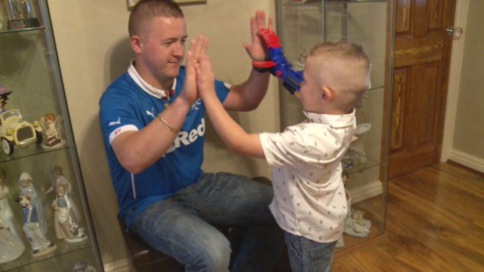 Five-year-old Cian Morris adapts to revolutionary 3D printed prosthetic ...