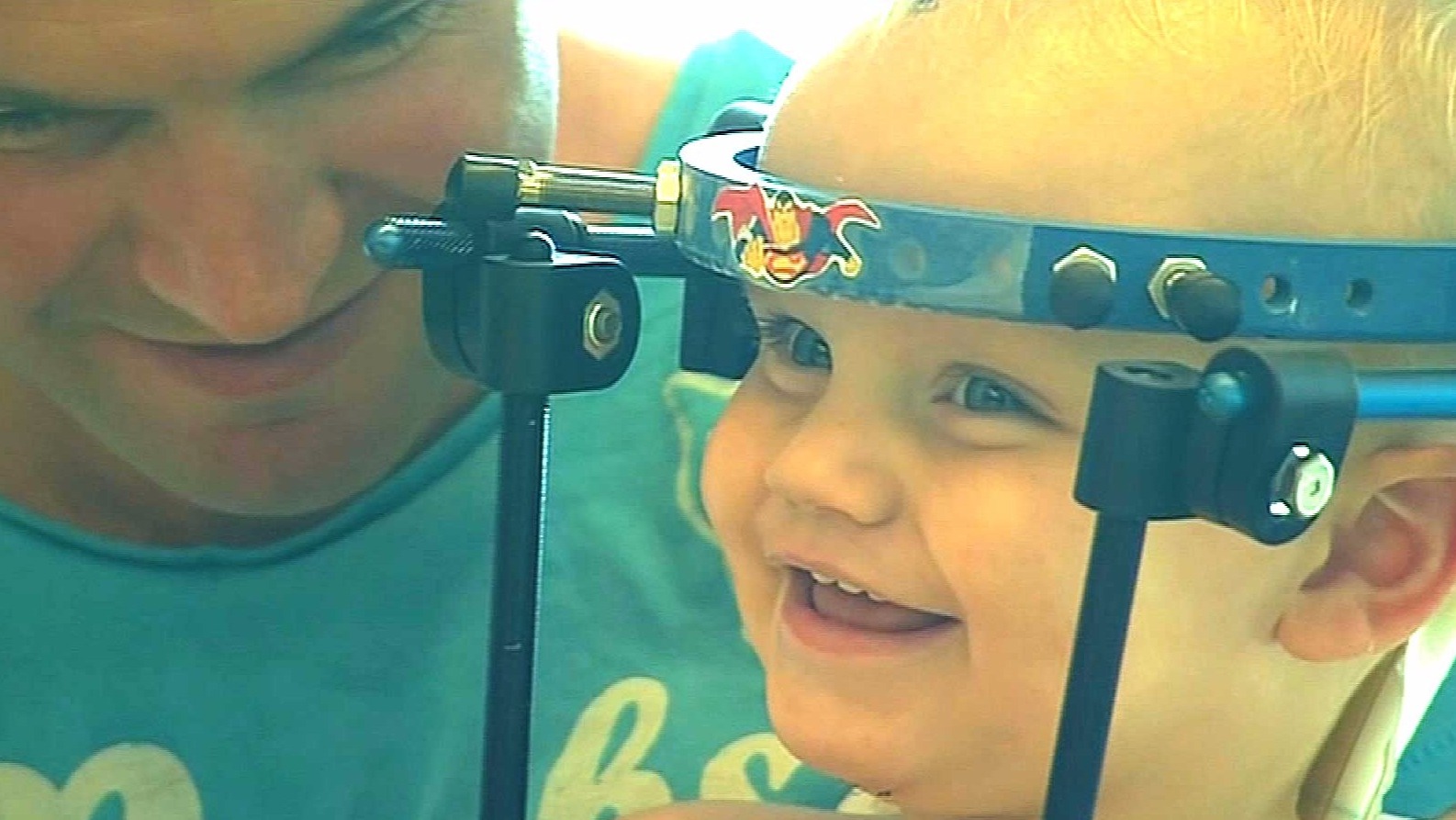 Toddler recovering after 'miracle' operation to reattach his head to ...