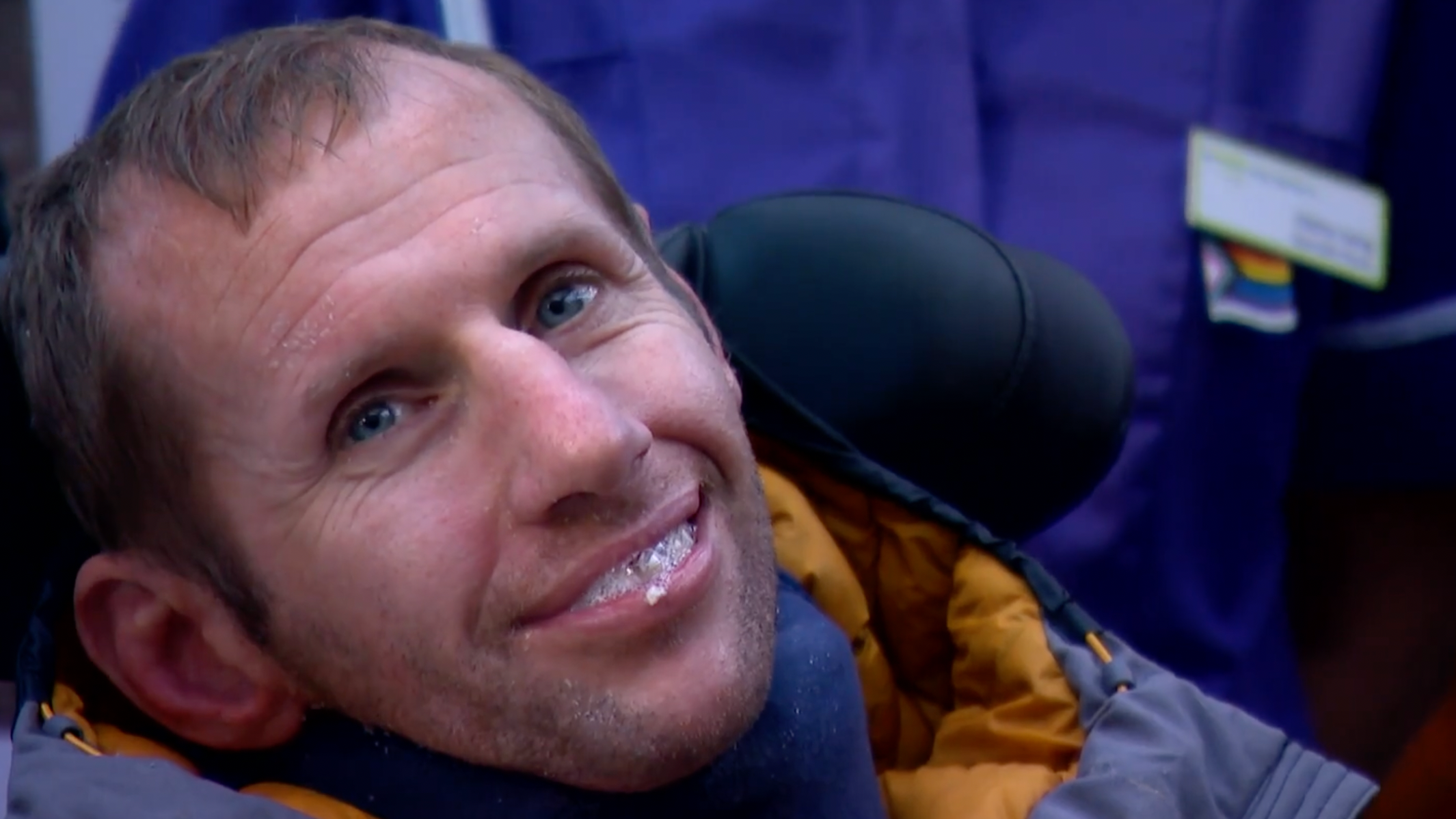 Rob Burrow says Leeds MND exhibition raises awareness of 'devastating ...