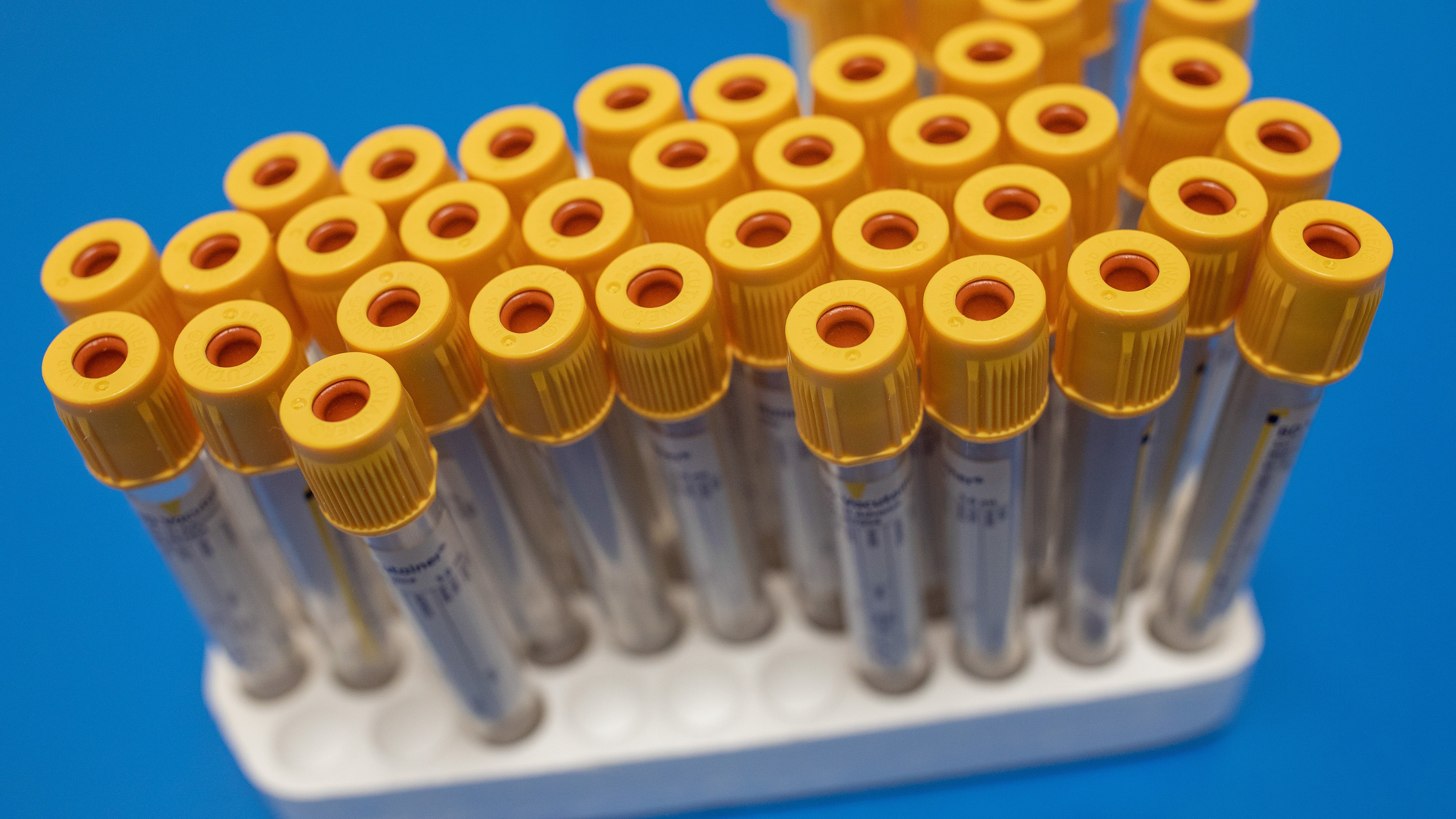 NHS given green light to offer 13,000 people living with HIV first long ...