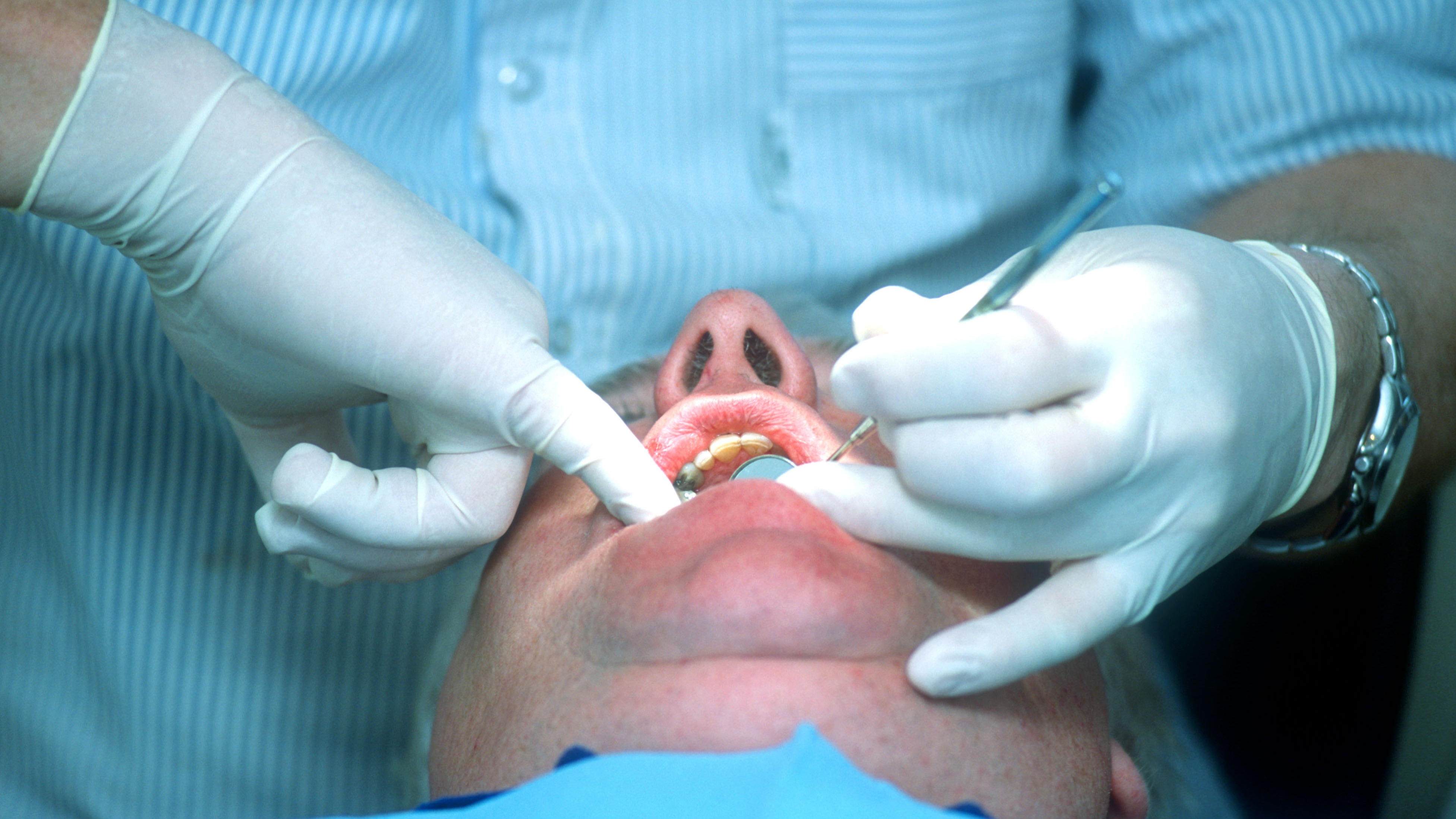 Ban on amalgam fillings in Northern Ireland avoided after EU agrees ...