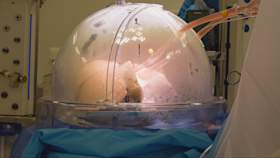 How new 'lung in a box' offers fresh hope for transplant patients ...