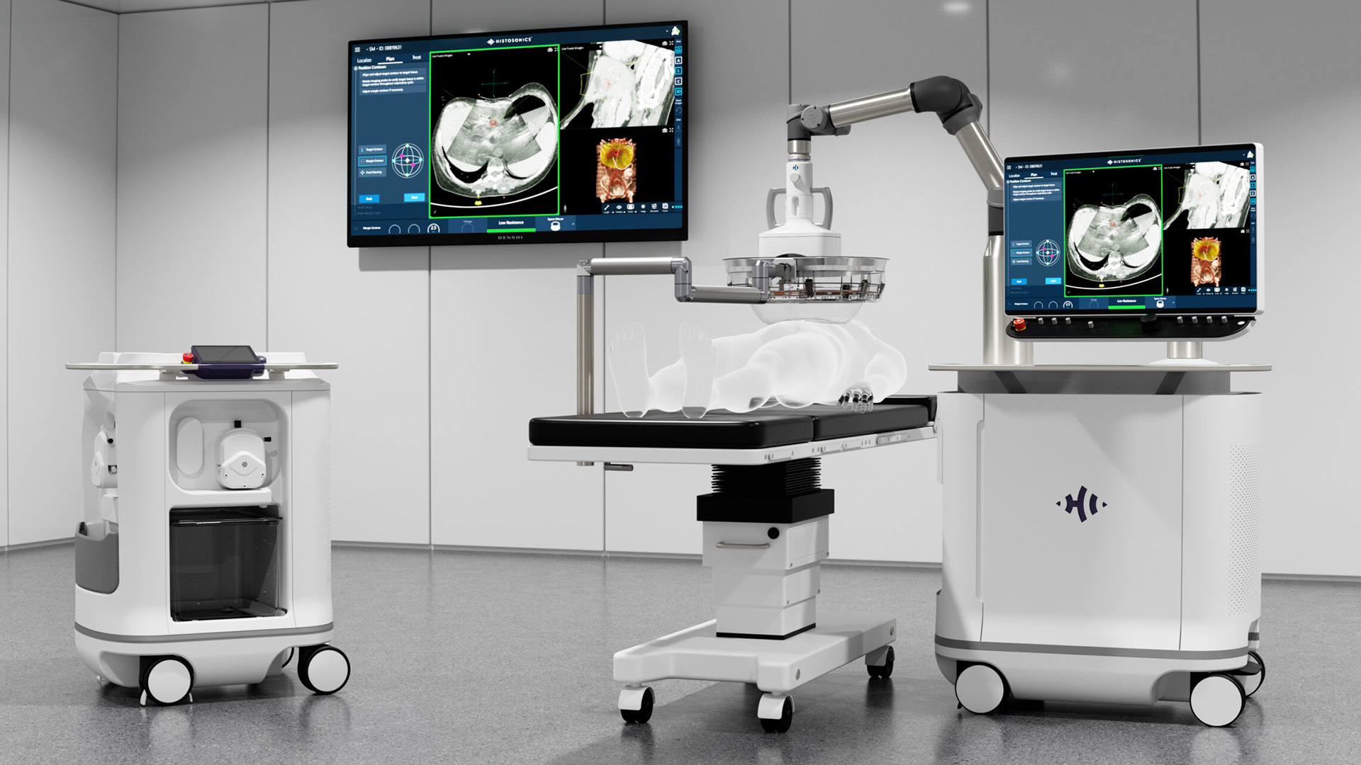 Histotripsy Cancer Treatment at Sharp Memorial Hospital | Sharp HealthCare