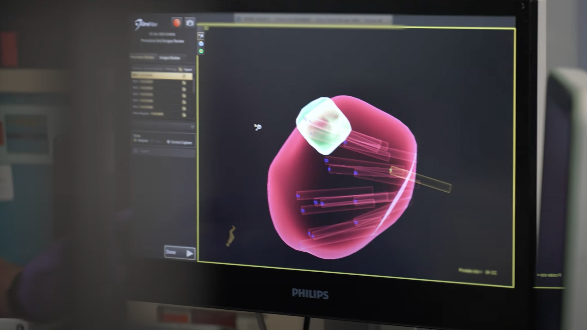 What is an MRI Guided Prostate Biopsy? | Video | Sharp HealthCare
