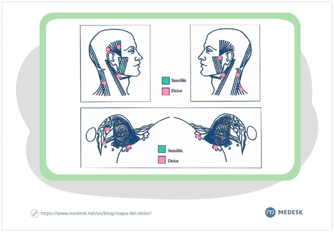 Mapa De Dolor Importancia Contenido Y Formatos En Fisioterapia