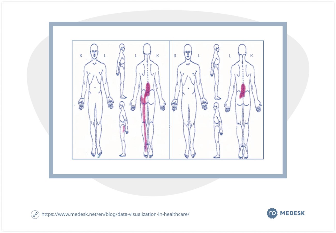 Key Aspects Of Healthcare Data Visualization