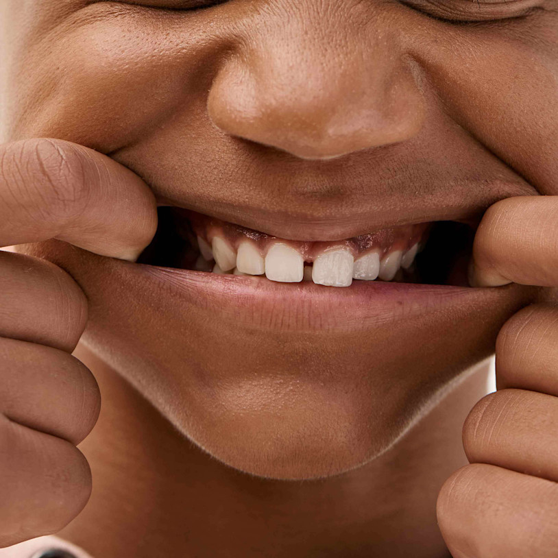 Modern Orthodontic Care for Kids - Two Front