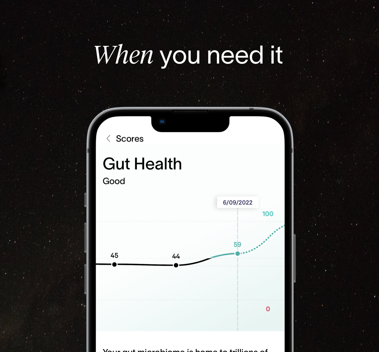 Gut Intelligence™ Test | Viome