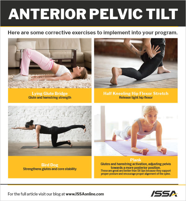 Pelvic Tilt: What Is It and How Do You Correct It? | ISSA
