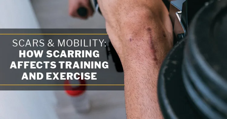 Scars & Mobility: How Scarring Affects Training and Exercise | ISSA