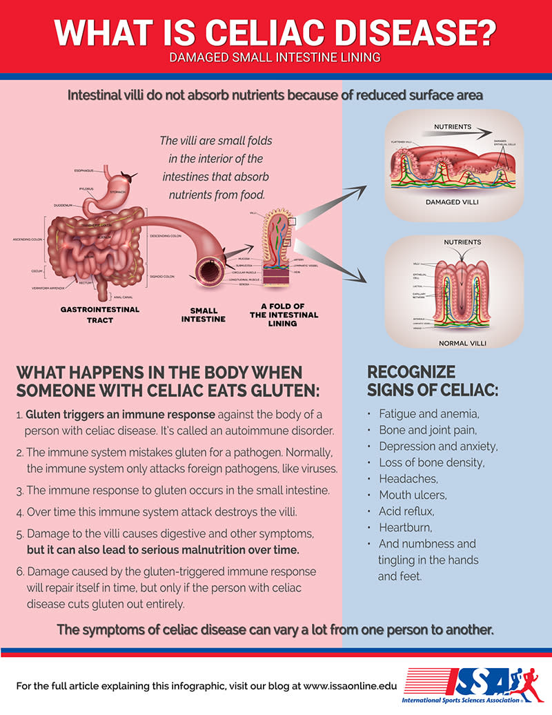 Celiac Disease or an Irrational Fear of Gluten? | ISSA