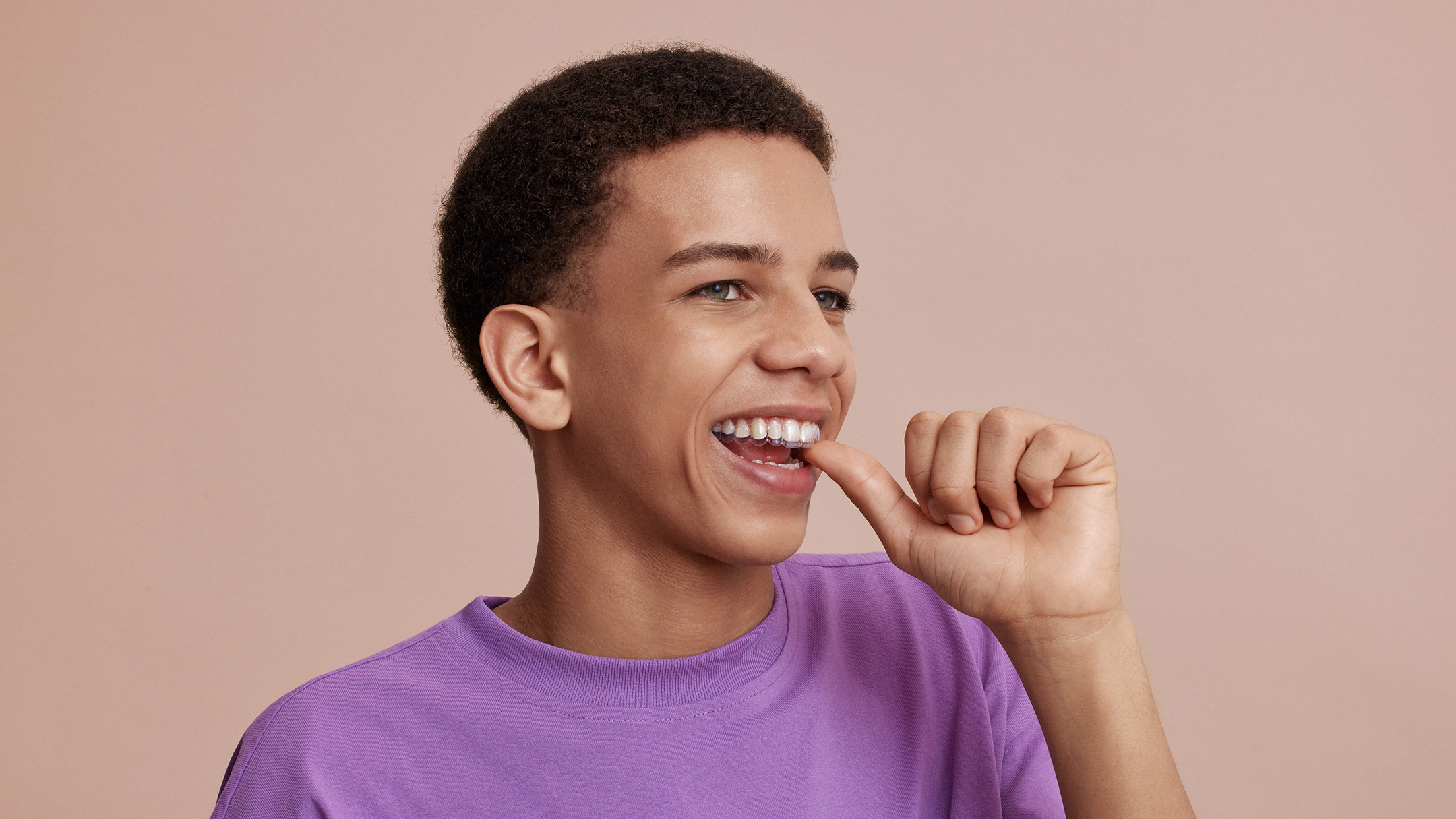 Migros-Tochter Bestsmile weitet Behandlungen von Zahnkorrekturen auf ...