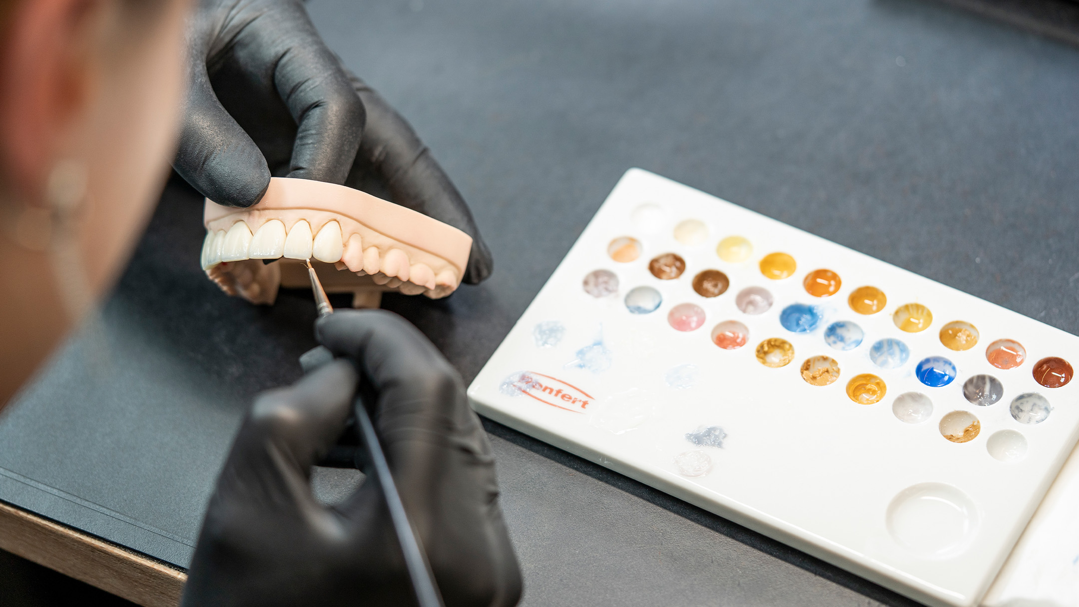 Migros start-up bestsmile doubles its production space in Winterthur ...
