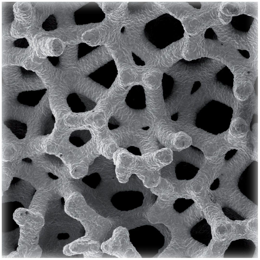 Trabecular Metal Technology | Zimmer Biomet | Zimmer Biomet