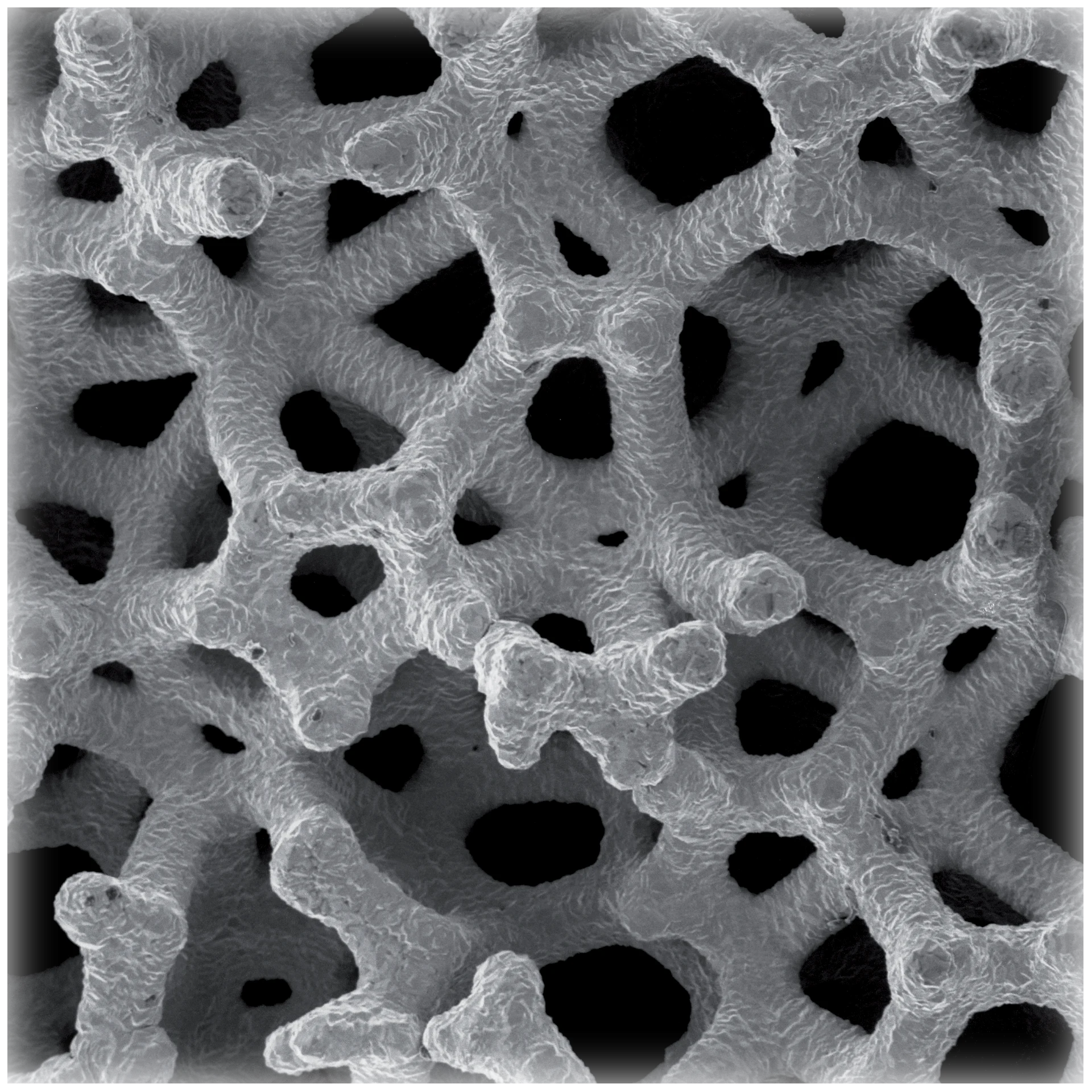 Trabecular Metal Technology | Zimmer Biomet | Zimmer Biomet