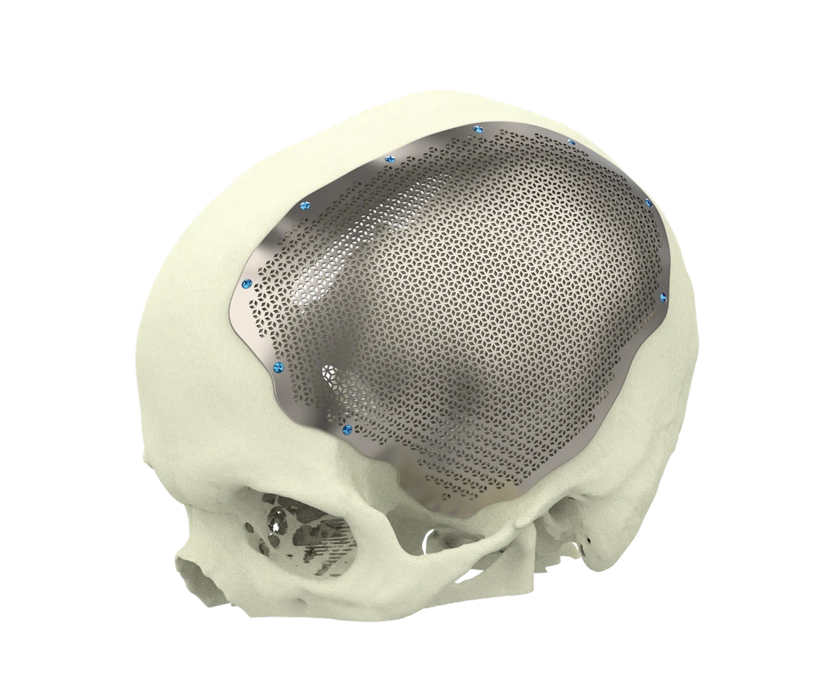 CMF: Trauma and Reconstruction | Zimmer Biomet