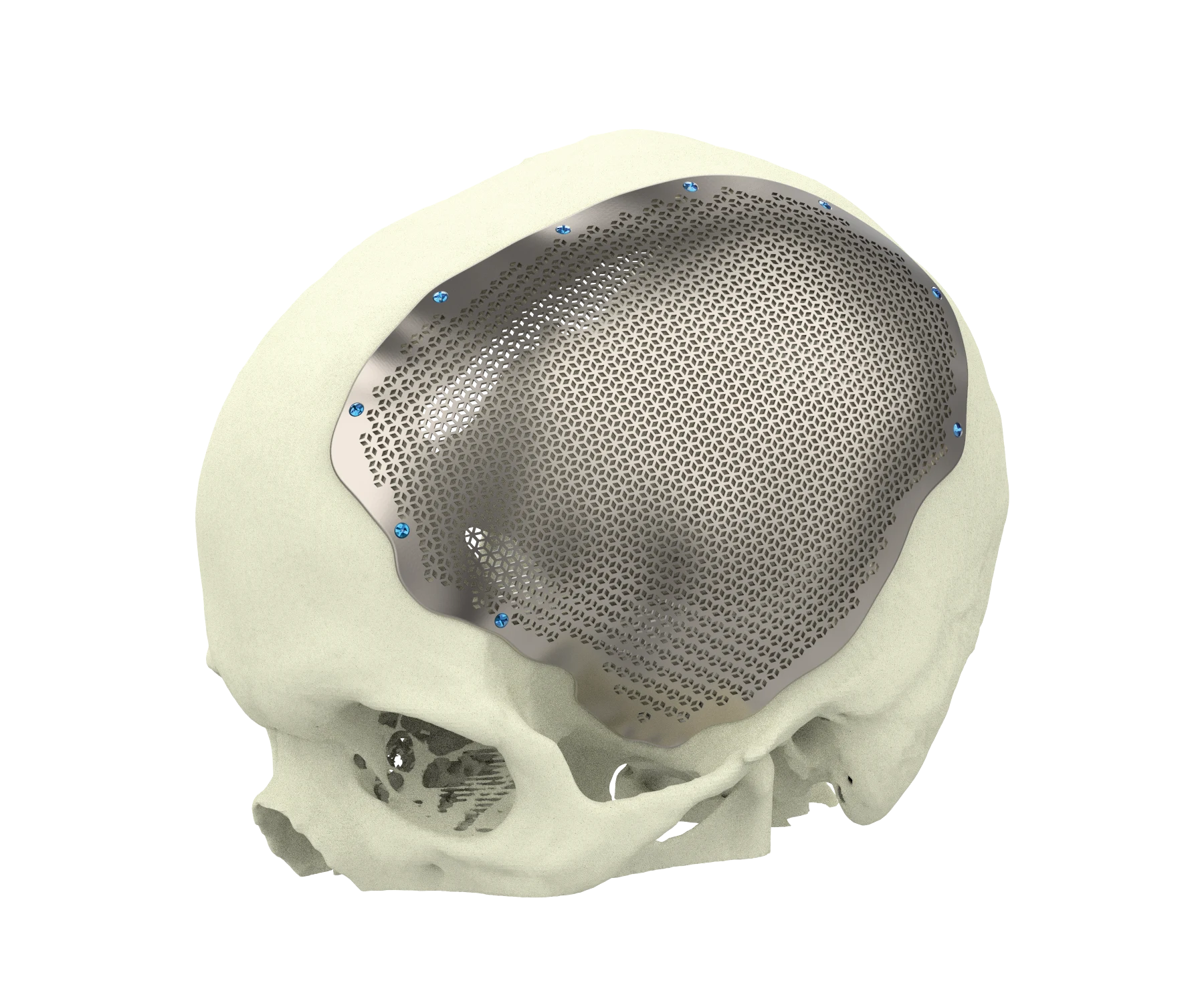 CMF: Trauma and Reconstruction | Zimmer Biomet