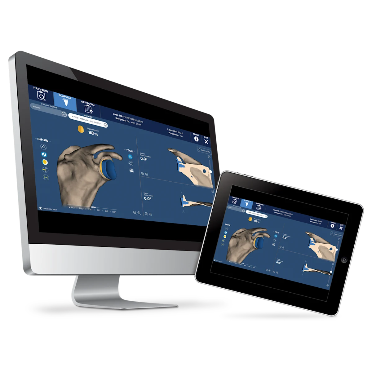 The Comprehensive Total Shoulder System | Zimmer Biomet